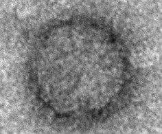 Polycipiviridae | ICTV